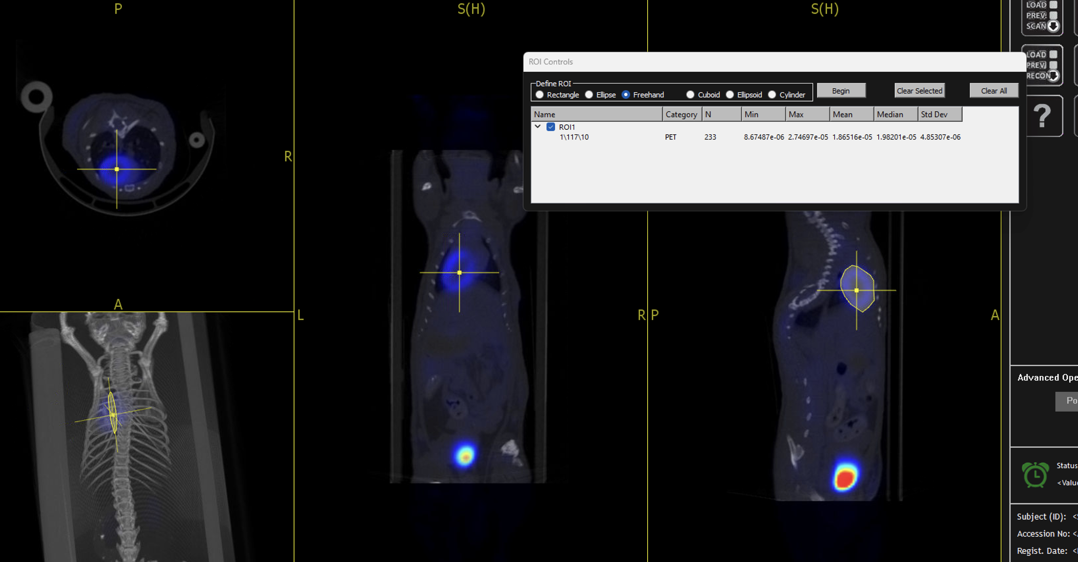 View Tab_ROIs1 - MR Solutions